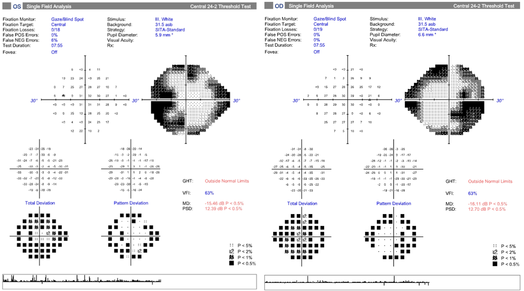 Gyrate Atrophy (Extract from CFEH Atlas) - Centre for Eye Health