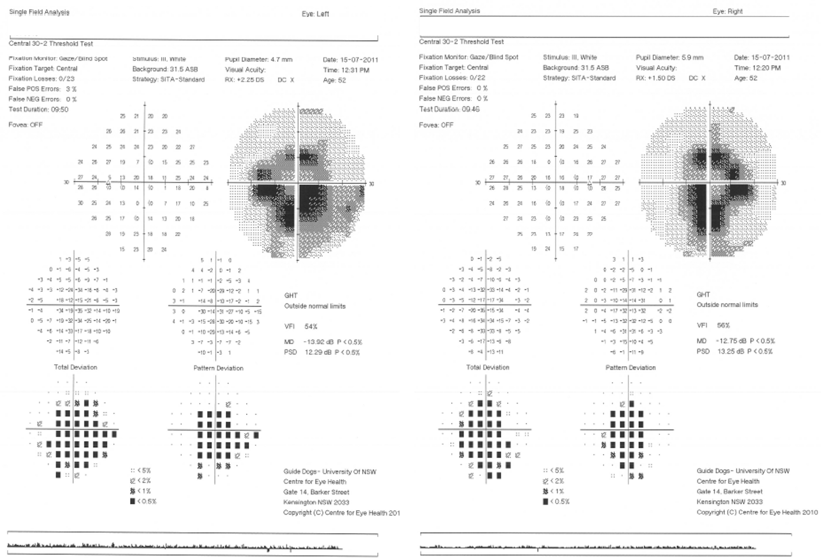 Congenital Stationary Nightblindness (CSNB) - Extract from CFEH Atlas ...