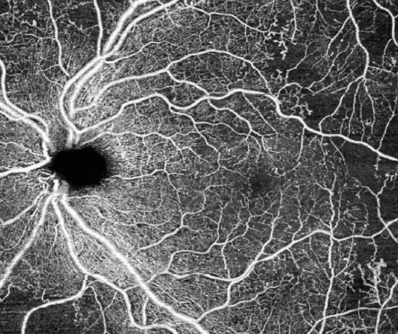 Upcoming Webinars - Centre for Eye Health