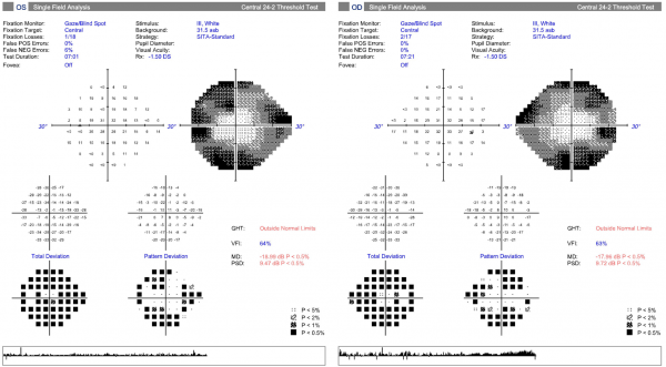 Retinitis Pigmentosa (Extract from the CFEH Atlas) - Centre for Eye Health